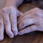 Migratory Arthralgia: Symptoms, Causes, Diagnosis, and Treatment